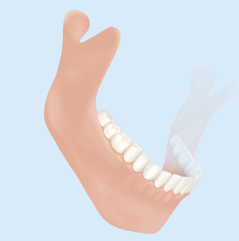 Illustration mâchoire inférieure – Auriane Vicente